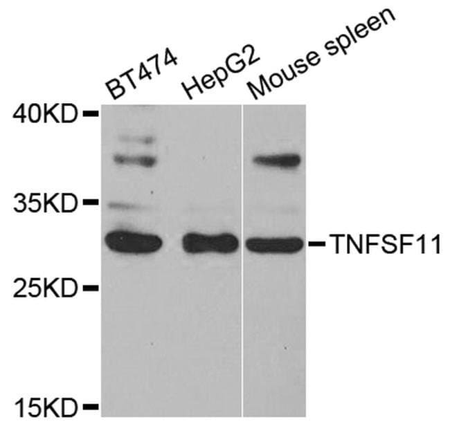 CD254 (RANK Ligand) Polyclonal Antibody, Invitrogen 100 μL ...