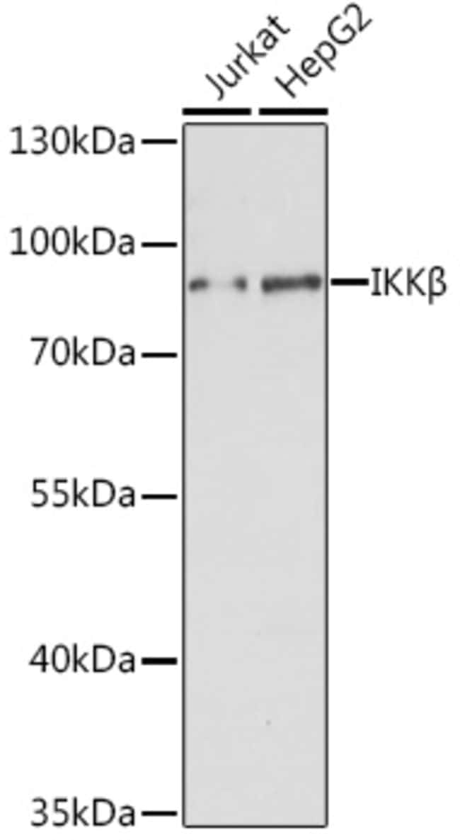 Invitrogen IKK beta Polyclonal Antibody 100 μL; Unconjugated:Antibodies, | Fisher Scientific