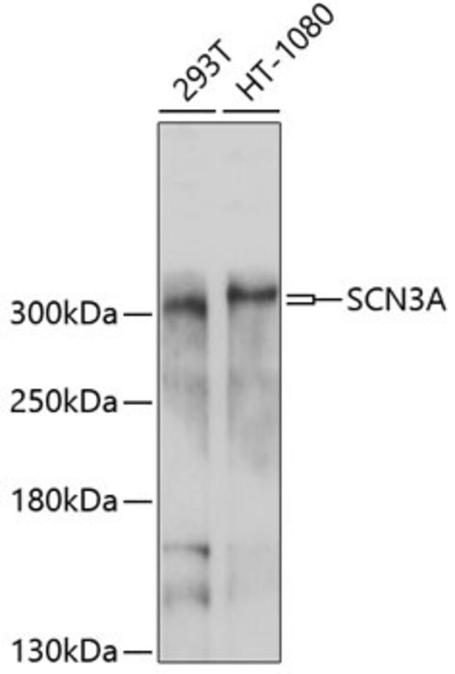 SCN3A Polyclonal Antibody, Invitrogen 100 μL; Unconjugated:Antibodies ...