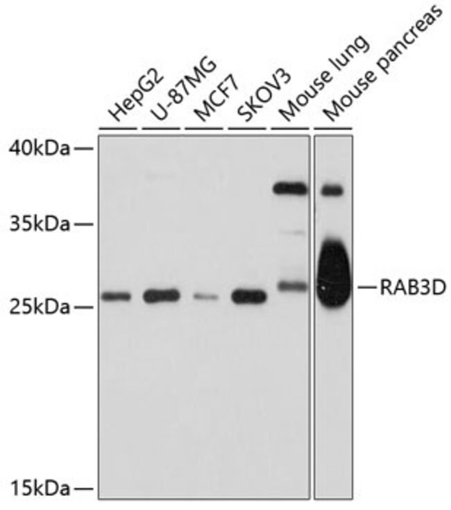 RAB3d Polyclonal Antibody, Invitrogen 100 μL; Unconjugated:Antibodies ...