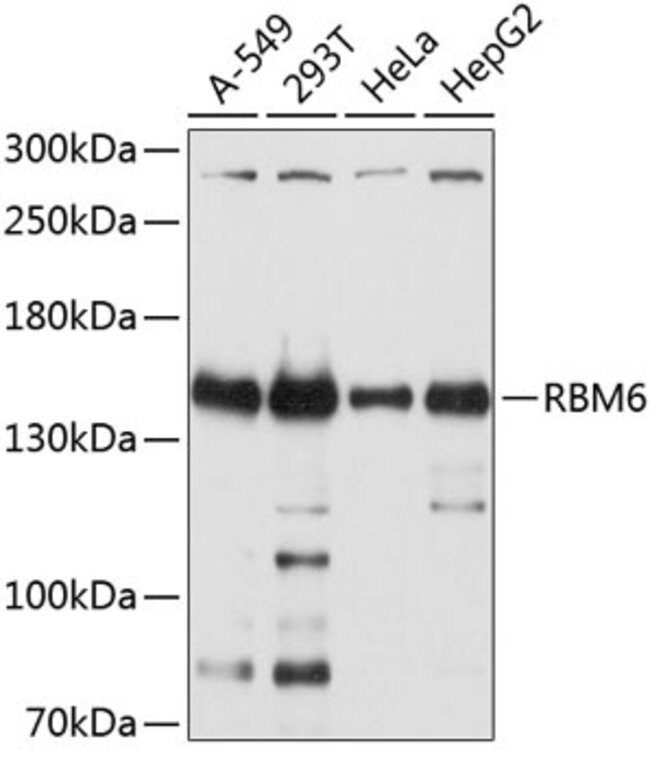RBM6 Rabbit anti-Human, Mouse, Rat, Polyclonal, Invitrogen 100 μL ...