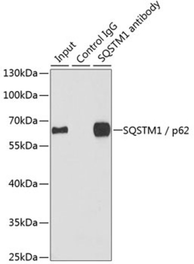 SQSTM1 Polyclonal Antibody, Invitrogen 100 μL; Unconjugated:Antibodies ...