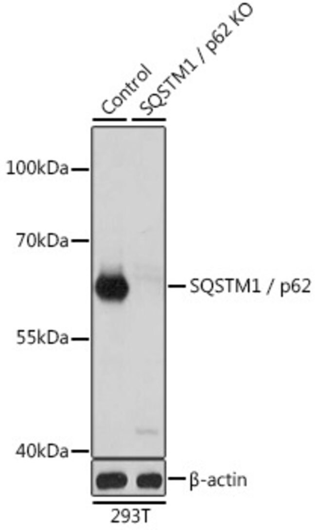 SQSTM1 Polyclonal Antibody, Invitrogen 100 μL; Unconjugated:Antibodies ...