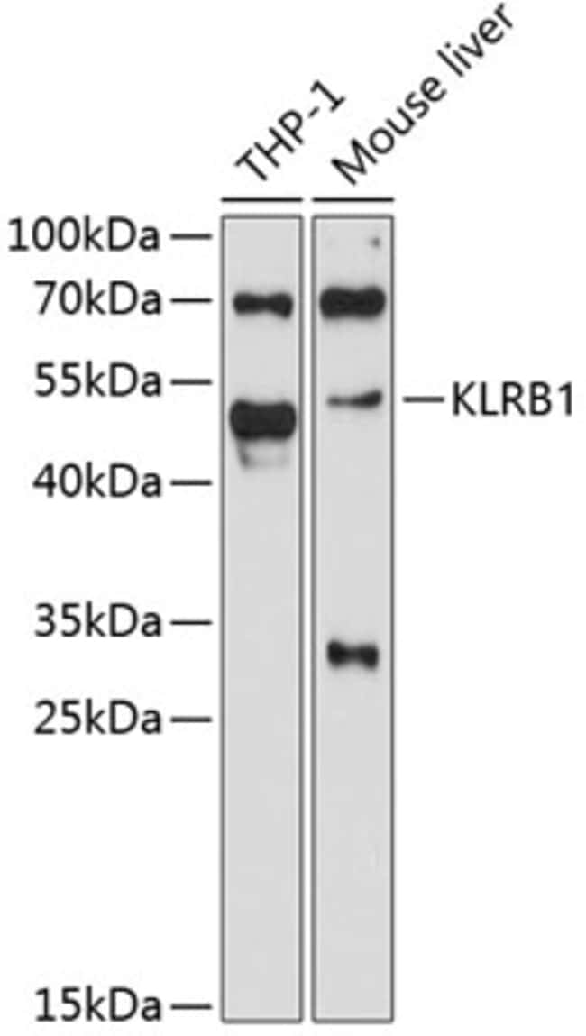 Invitrogen KLRB1 Polyclonal Antibody 100 μL; Unconjugated:Antikroppar ...