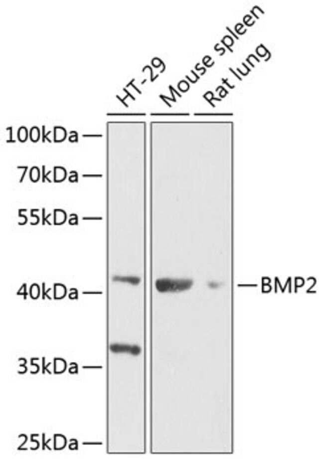 BMP-2 Polyclonal Antibody, Invitrogen 100 μL; Unconjugated:Antibodies ...