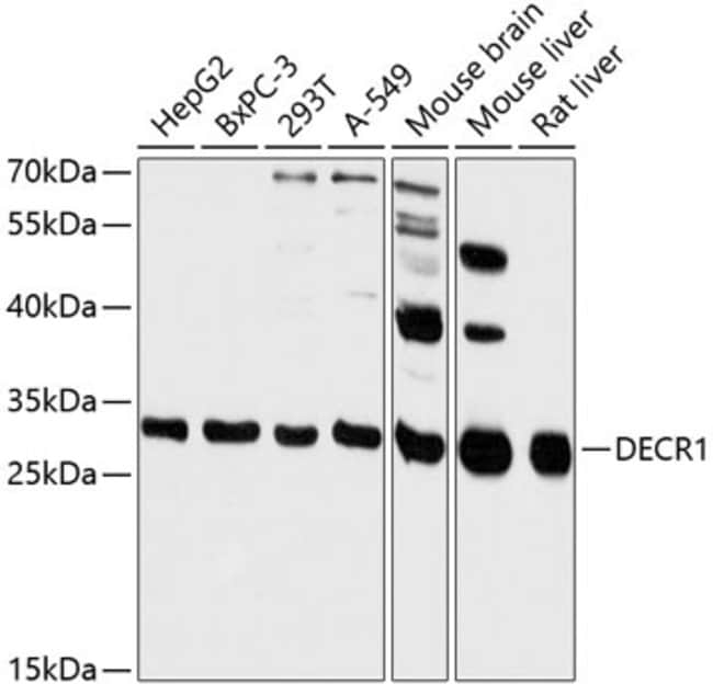 DECR1 Polyclonal Antibody, Invitrogen 100 μL; Unconjugated:Antibodies ...