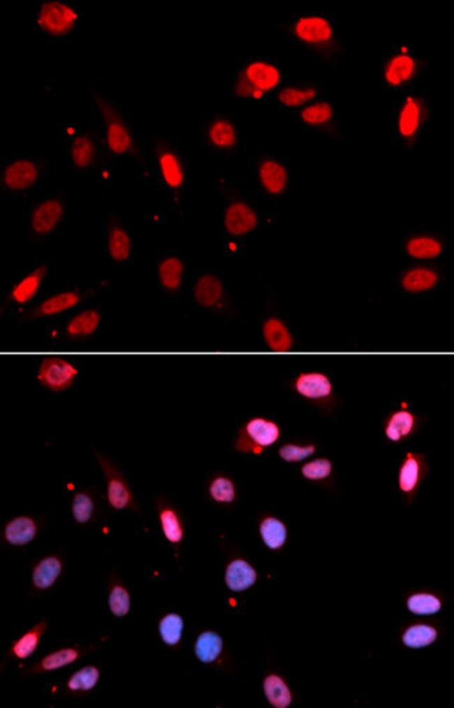 RAD18 Polyclonal Antibody, Invitrogen 100 μL; Unconjugated:Antibodies ...