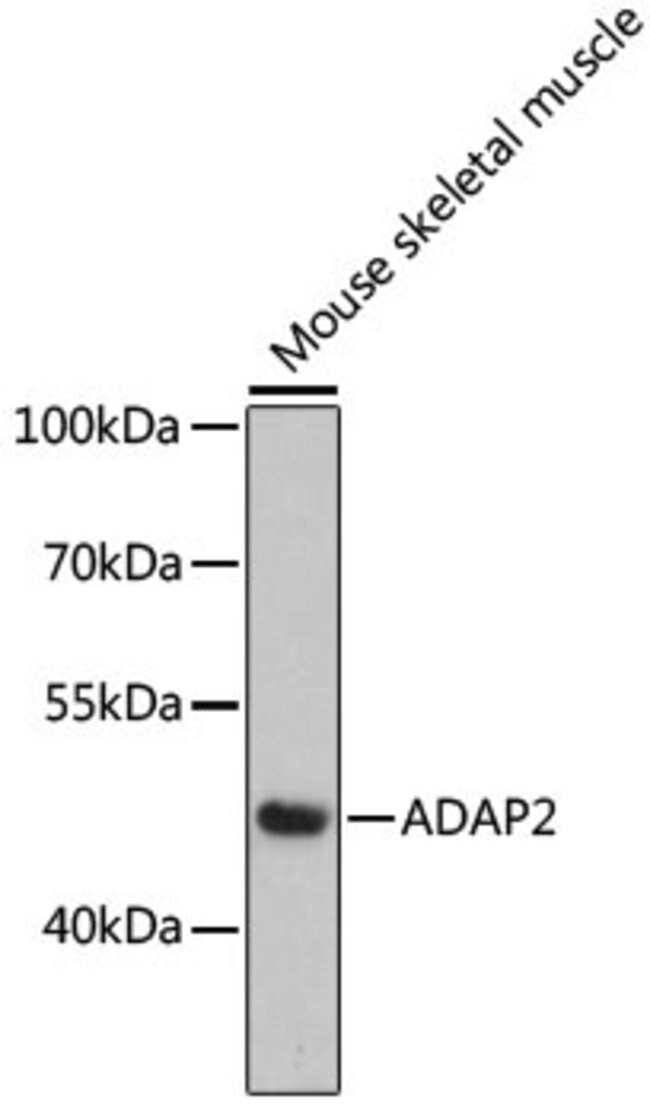 Centaurin alpha-2 Polyclonal Antibody, Invitrogen 100 μL; Unconjugated ...