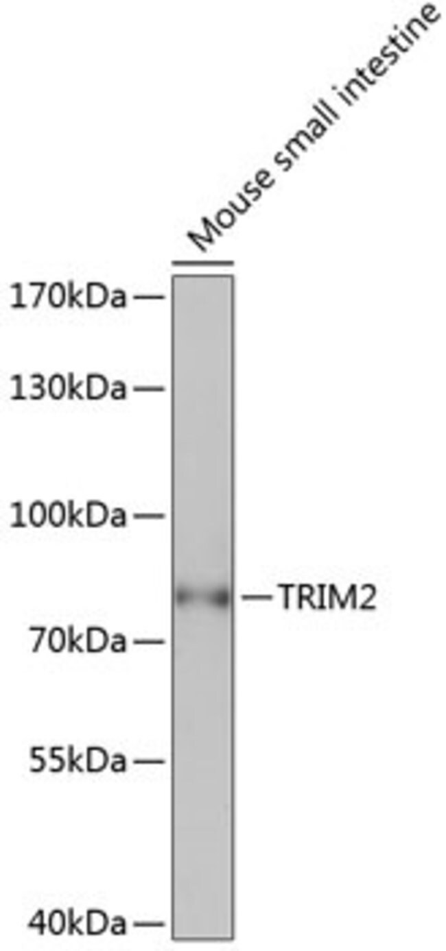 TRIM2 Polyclonal Antibody, Invitrogen 100 μL; Unconjugated:Antibodies ...
