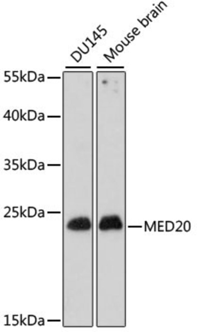 MED20 Polyclonal Antibody, Invitrogen 100 μL; Unconjugated:Antibodies ...