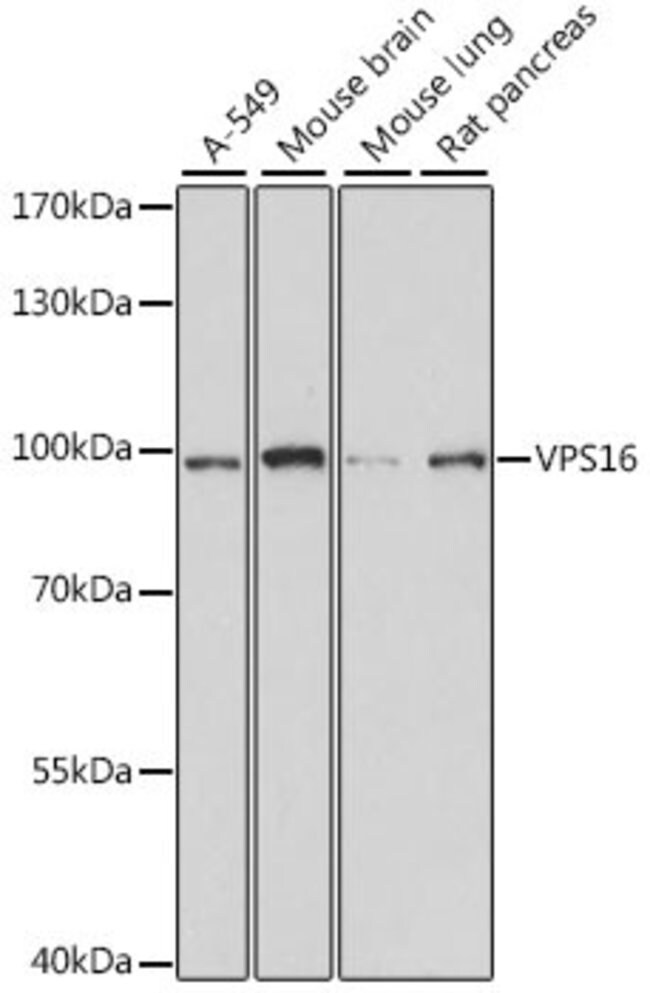 VPS16 Polyclonal Antibody, Invitrogen 100 μL; Unconjugated:Antibodies ...