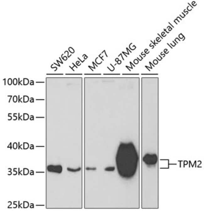 TPM2 Polyclonal Antibody, Invitrogen 100 μL; Unconjugated:Antibodies ...