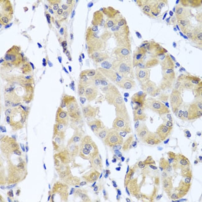 CBR4 Polyclonal Antibody, Invitrogen 100 μL; Unconjugated:Antibodies ...