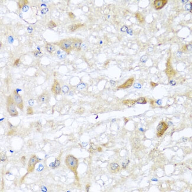 CBR4 Polyclonal Antibody, Invitrogen 100 μL; Unconjugated:Antibodies ...