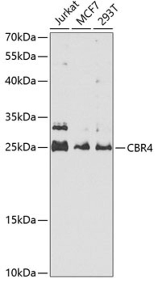 CBR4 Polyclonal Antibody, Invitrogen 100 μL; Unconjugated:Antibodies, | Fisher Scientific