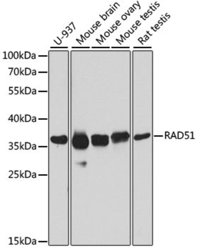 RAD51 Polyclonal Antibody, Invitrogen 100 μL; Unconjugated:Antibodies ...