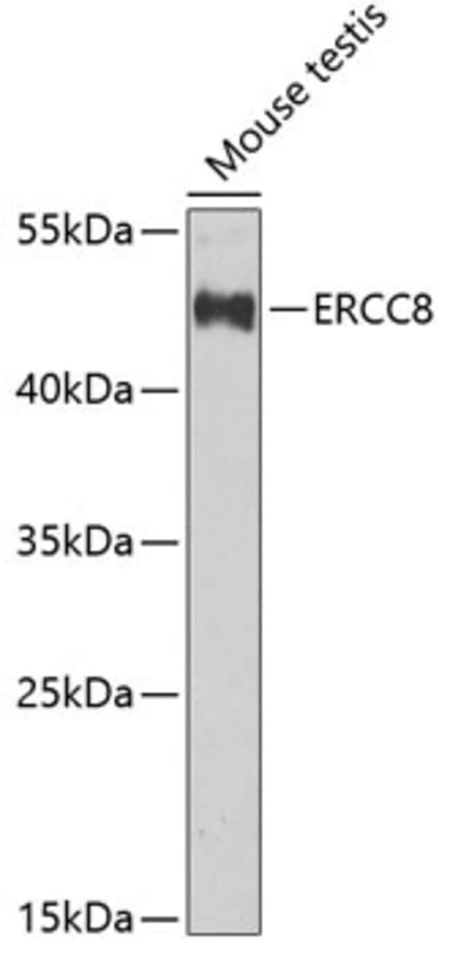 ERCC8 Polyclonal Antibody, Invitrogen 100 μL; Unconjugated:Antibodies ...