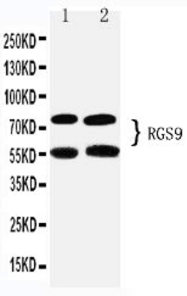 Invitrogen RGS9 Polyclonal Antibody 100 μg; Unconjugated:Antibodies ...