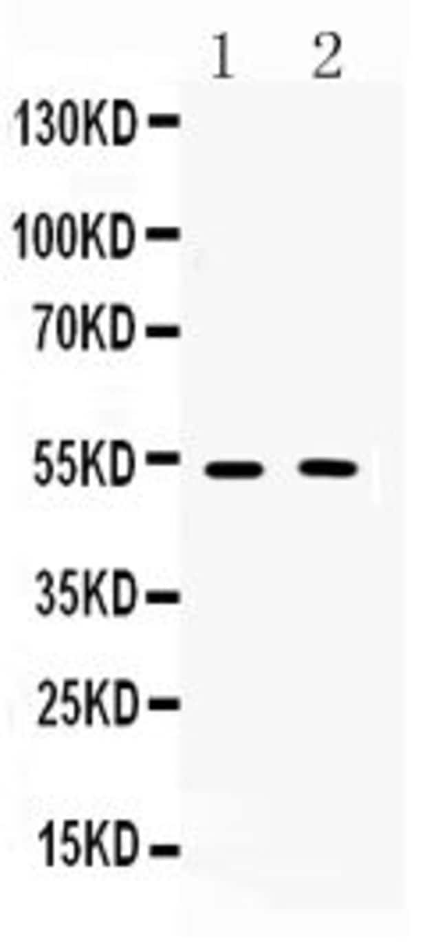 Invitrogen CHRM2 Polyclonal Antibody 100 μg | Buy Online | Invitrogen ...
