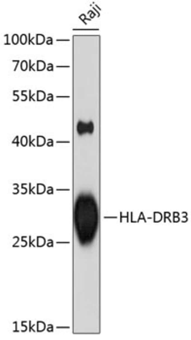 HLA-DRB3 Polyclonal Antibody, Invitrogen 100 μL; Unconjugated ...