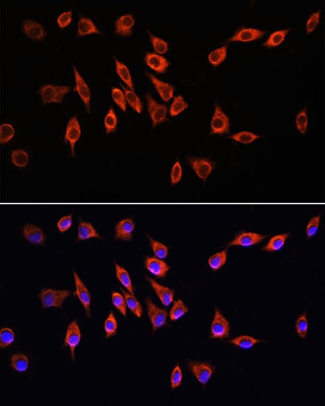 Neuropilin-1 Polyclonal Antibody, Invitrogen 100 μL; Unconjugated ...