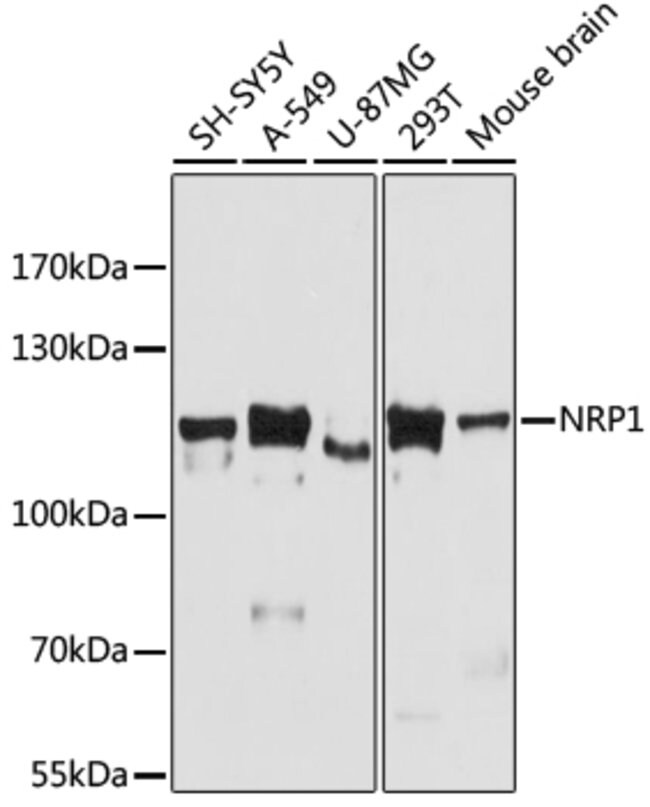 Neuropilin-1 Polyclonal Antibody, Invitrogen 100 μL; Unconjugated ...