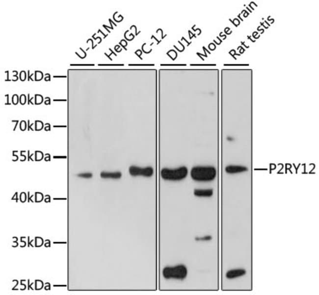 P2Y12 Polyclonal Antibody, Invitrogen 100 μL; Unconjugated:Antibodies ...