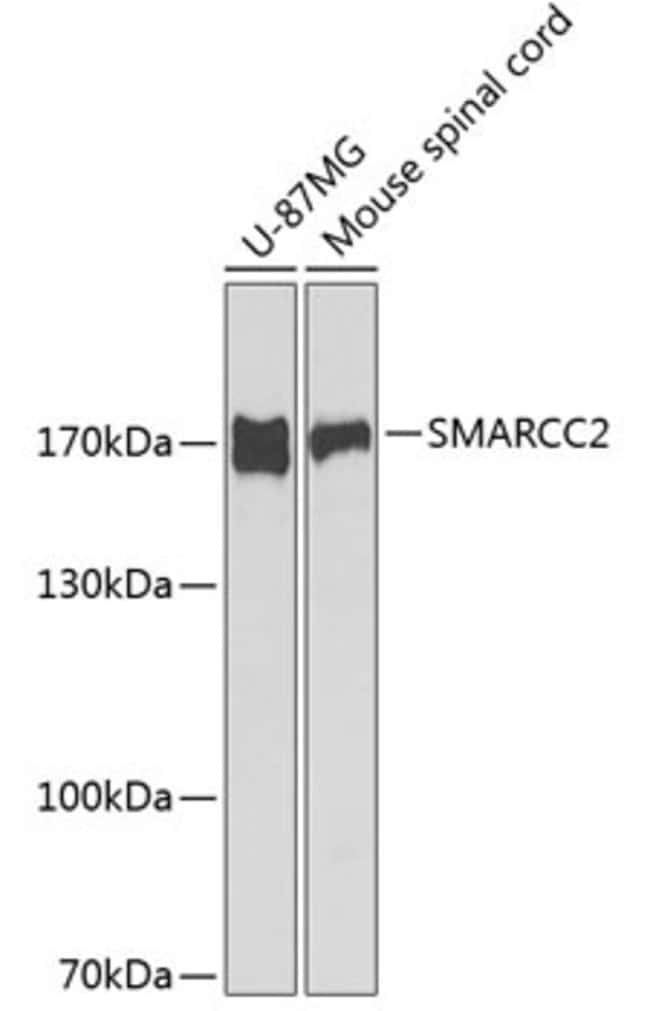 SMARCC2 Polyclonal Antibody, Invitrogen 100 μL; Unconjugated:Antibodies ...