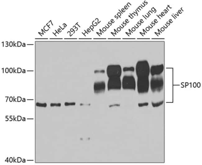 Invitrogen SP100 Polyclonal Antibody 100 μL; Unconjugated:Antibodies ...