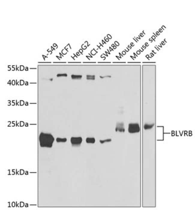 Flavin reductase Polyclonal Antibody, Invitrogen 100 μL; Unconjugated ...