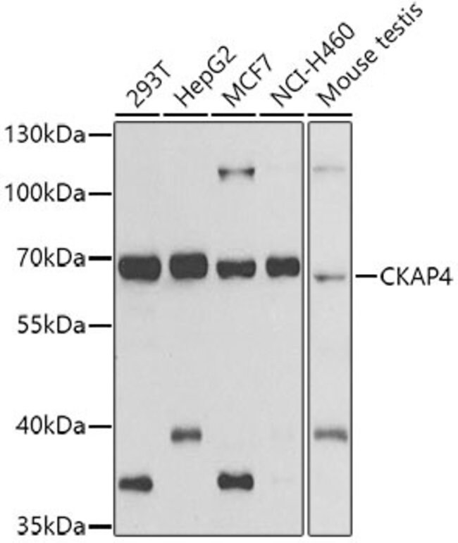 CKAP4 Polyclonal Antibody, Invitrogen 100 μL; Unconjugated:Antibodies ...