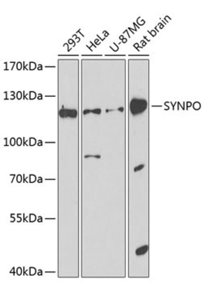 Synaptopodin Polyclonal Antibody, Invitrogen 100 μL; Unconjugated ...