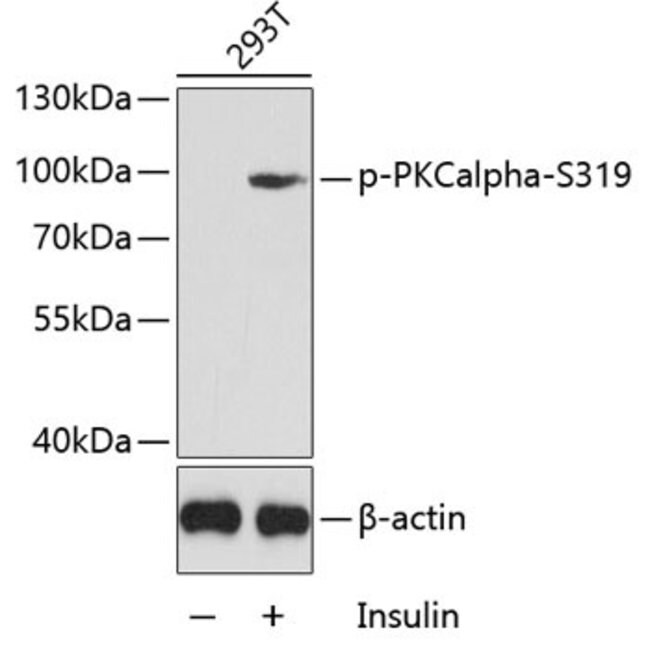 Phospho-PKC alpha (Ser319) Polyclonal Antibody, Invitrogen 100 μL; Unconjugated:Antibodies ...