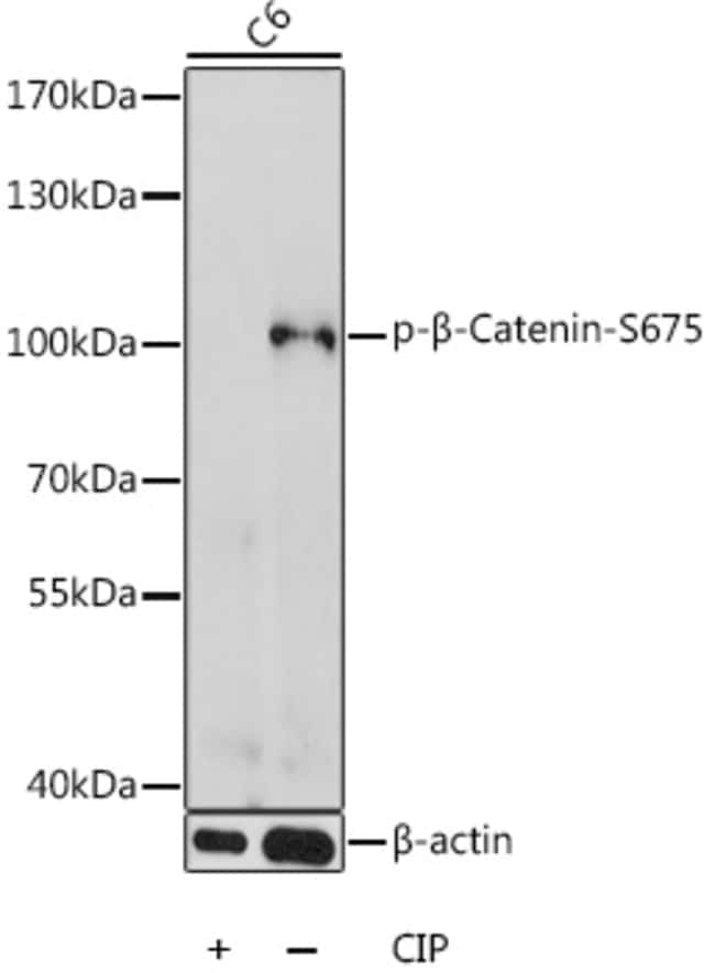 Invitrogen Phospho-beta Catenin (Ser675) Polyclonal Antibody 100 μL ...