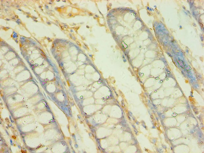 Invitrogen BCAT2 Polyclonal Antibody 100 μL; Unconjugated:Antibodies ...