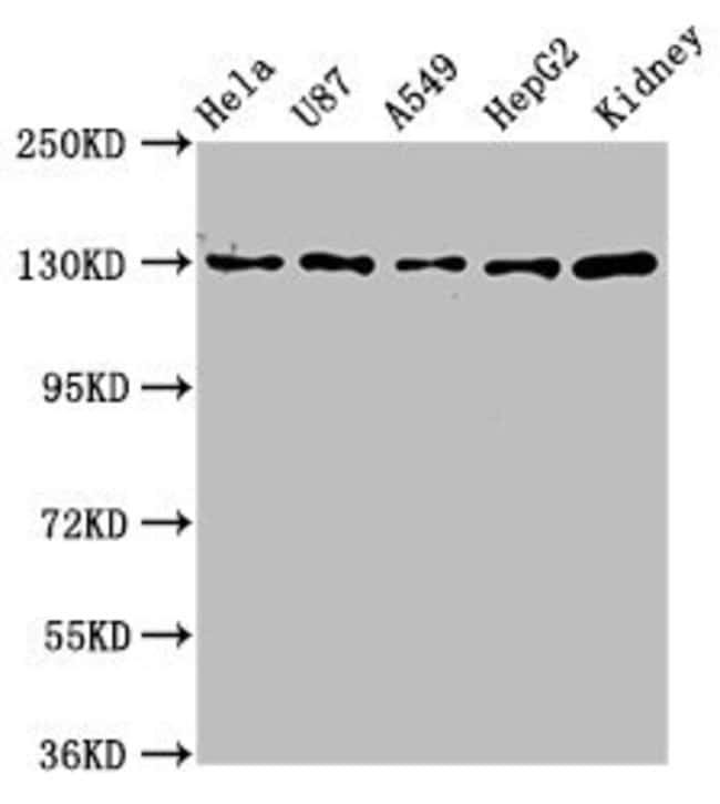 NKCC1 Polyclonal Antibody, Invitrogen 100 μg; Unconjugated:Antibodies ...