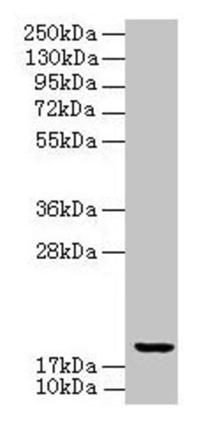 UBE2G2 Polyclonal Antibody, Invitrogen 100 μg; Unlabeled:Antibodies ...