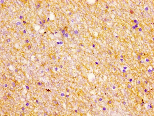 ATL3 Polyclonal Antibody, Invitrogen 100 μg; Unconjugated:Antibodies ...