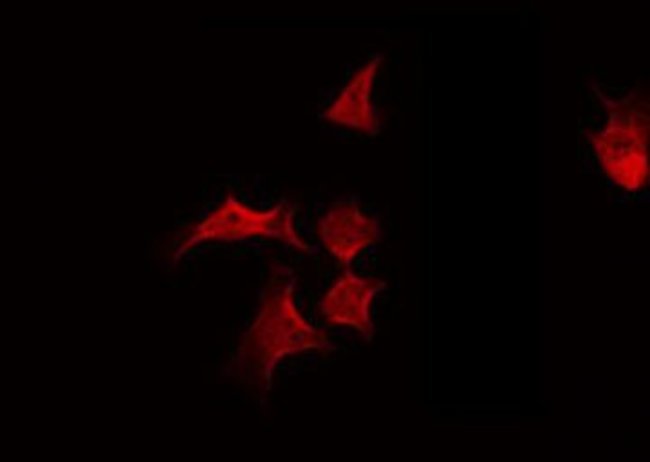 alpha Adducin Polyclonal Antibody, Invitrogen™ 100 μL; Unconjugated ...