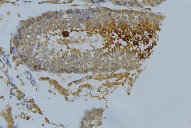 alpha Adducin Polyclonal Antibody, Invitrogen™ 100 μL; Unconjugated ...
