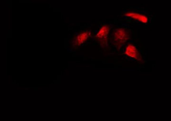 RelB Polyclonal Antibody, Invitrogen 100 μL; Unconjugated:Antibodies ...