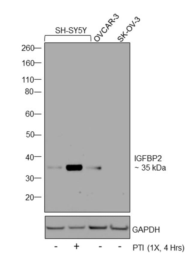 Invitrogen IGFBP2 Polyclonal Antibody 100 μL; Unconjugated:Antibodies, | Fisher Scientific