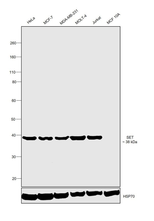 SET Polyclonal Antibody, Invitrogen™ 100 μg; Unconjugated | Fisher ...