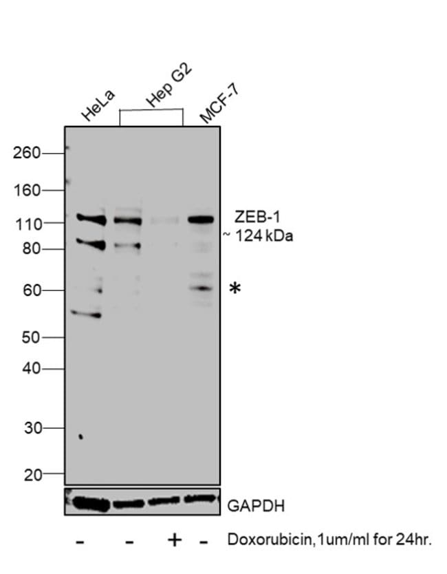 ZEB1 Polyclonal Antibody, Invitrogen 100 μg; Unconjugated:Antibodies, | Fisher Scientific