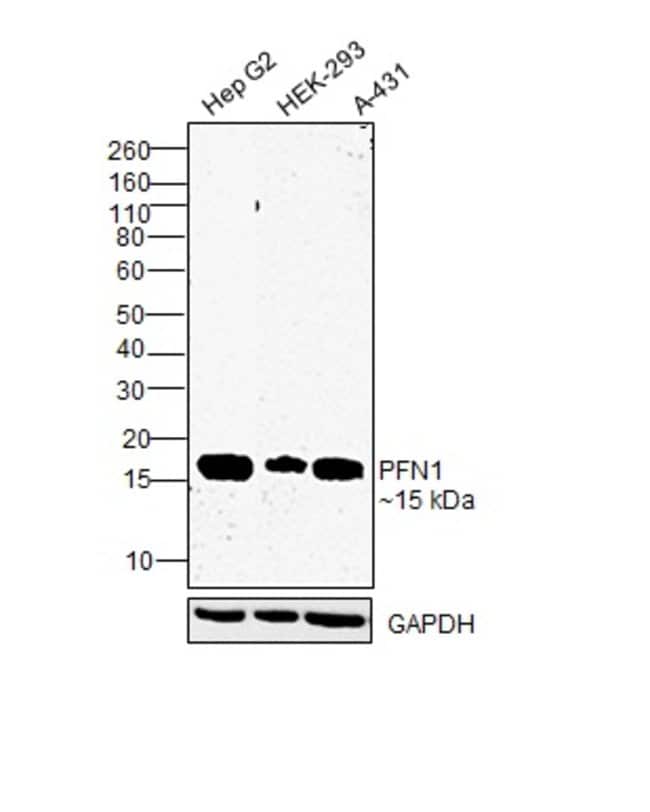 Invitrogen Profilin 1 Polyclonal Antibody 100 μL; Unconjugated:Antikroppar | Fisher Scientific