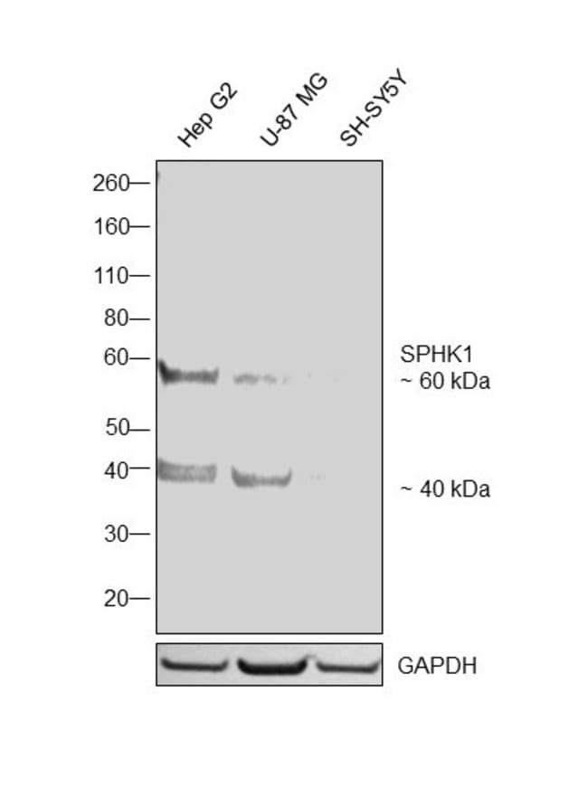 Invitrogen SPHK1 Polyclonal Antibody 100 μL; Unconjugated:Antikroppar ...