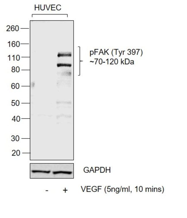 Invitrogen Phospho-FAK (Tyr397) Polyclonal Antibody 100 μL ...