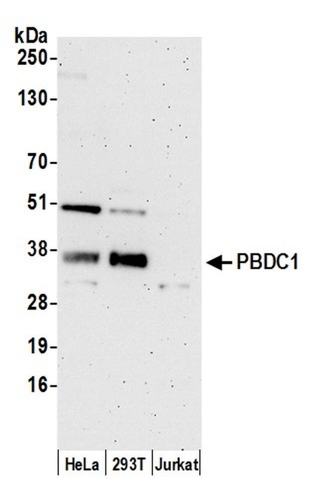 PBDC1, Polyclonal, Bethyl Laboratories:Antibodies:Primary Antibodies ...