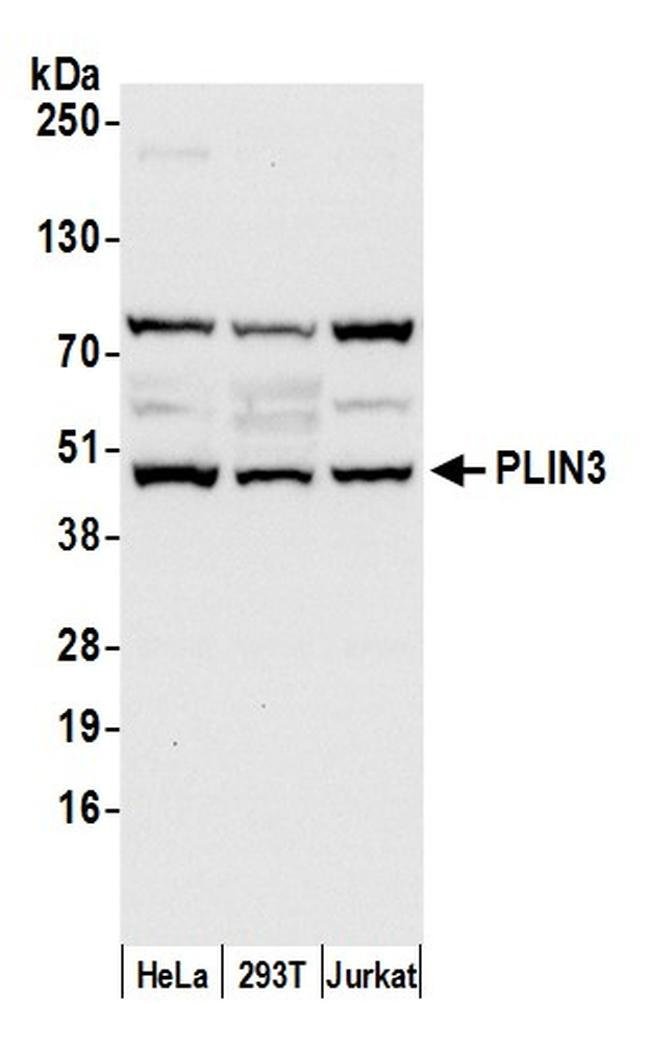 PLIN3, Polyclonal, Bethyl Laboratories:Antibodies:Primary Antibodies ...