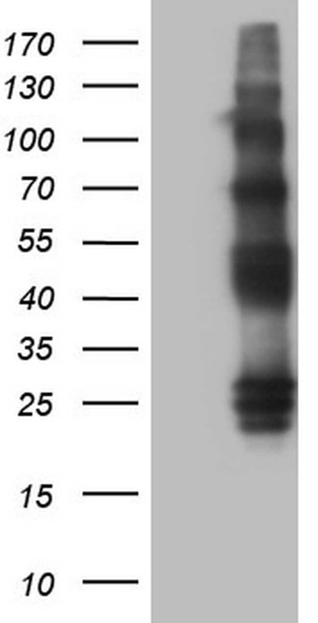 PROCR Monoclonal Antibody (OTI2G2), TrueMAB , OriGene 100 μL ...